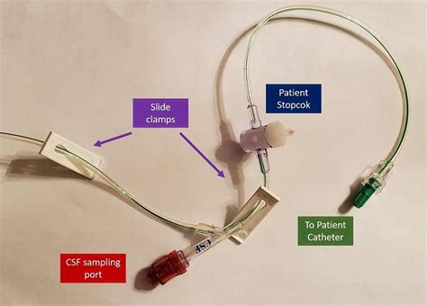 Procedure Setup And Use Of Codman Eds 3 External Ventricular Drainage