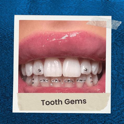 Tooth Gem Care 101 How To Keep Your Smile Sparkling And Safe