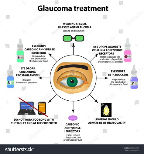 Glaucoma Treatment Eye Drops World Glaucoma Stock Vector Royalty Free