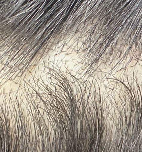 붙임머리 뗀 후 매직 지식in