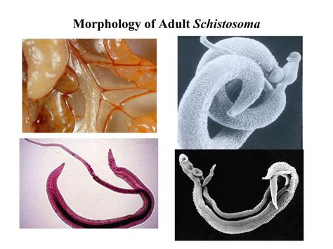 Schistosomes Ppt