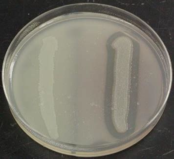 Casein Hydrolysis Test