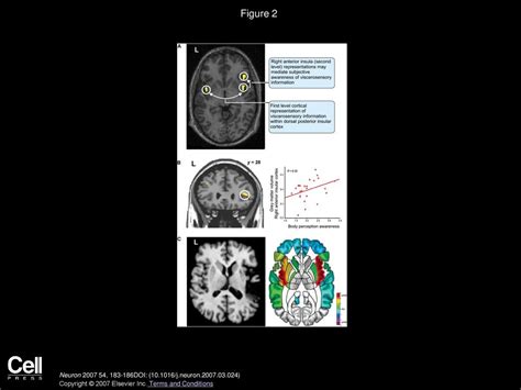 Interoceptive Basis To Craving Ppt Download