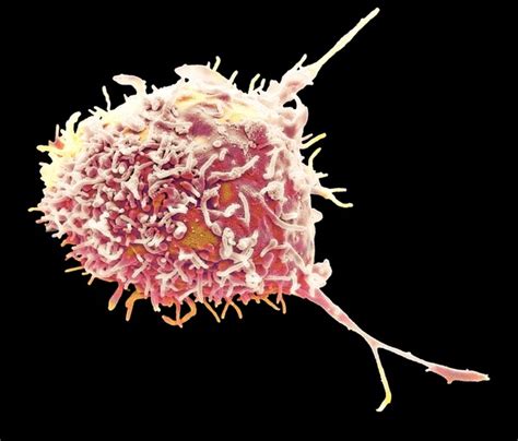 792 Cell Electron Micrograph Royalty Free Photos And Stock Images