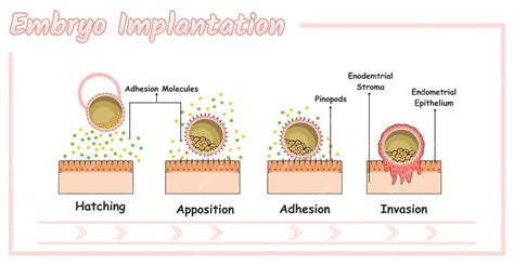 Premium Vector Embryo Implantation