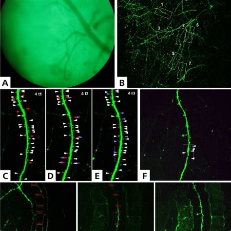 Two Photon Imaging Of Mouse Brain Neurons In Living Mice Bars A