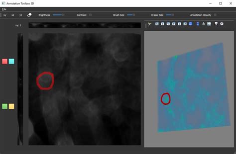 Unet Segmentation · Github Topics · Github