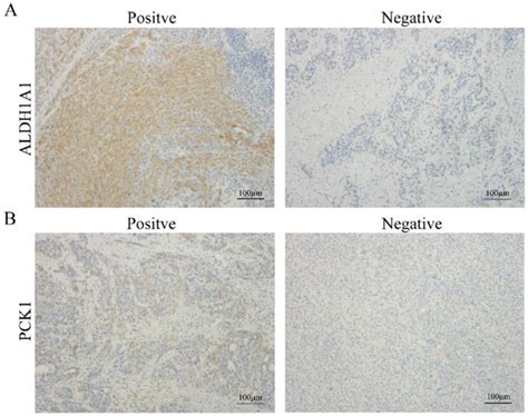 Pck1 And Aldh1a1 Are Identified As Biomarkers For Inherent Drug