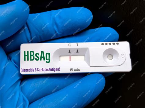 Premium Photo Hbsag Hepatitis B Virus Surface Antigen Test Kit With