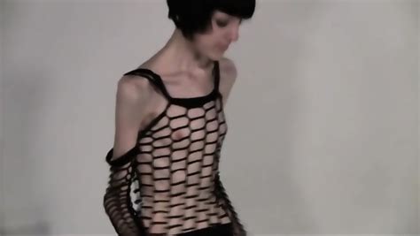 Skin And Bones Eporner Skin And Bones Eporner