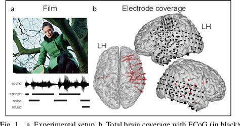 Figure 1 From Towards Naturalistic Speech Decoding From Intracranial