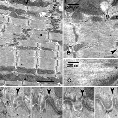 Pdf The Transitional Junction A New Functional Subcellular Domain At The Intercalated Disc