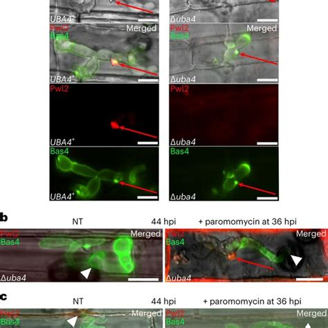 Trna Anticodon Wobble Uridine 2 Thiolation Is Required For Fungal