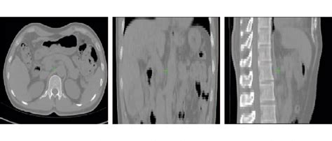 Figure 1 From Mm Gan 3d Mri Data Augmentation For Medical Image Segmentation Via Generative