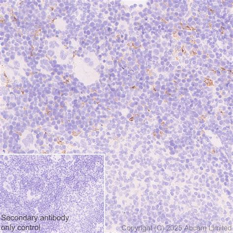 Anti Cd5l Ct 2 Antibody [epr29364 21] Ab324193 Abcam