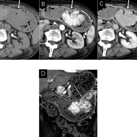 Dynamic Contrast Enhanced Computed Tomography Ct Scans A Download Scientific Diagram