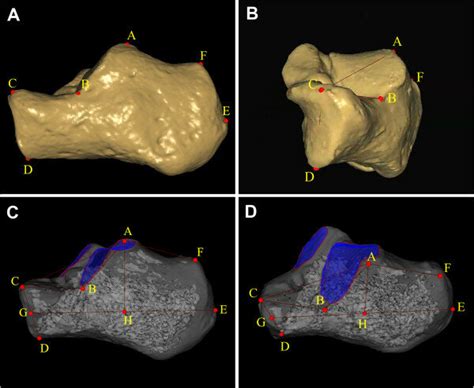 Three Dimensional Morphological Measurements Of Calcaneus A B