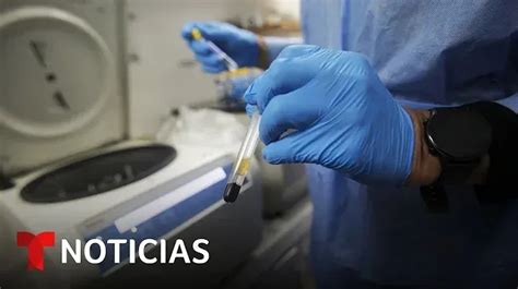 Entendiendo La Diferencia Entre Sida Y Vih Situam Os