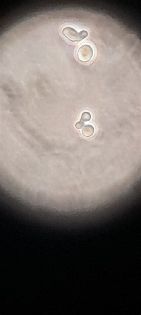 280 Questions With Answers In Turbidity Science Topic