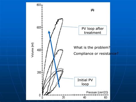 Ppt Ventilator Waveform Analysis Often Ignored Bedside Assessment Powerpoint Presentation