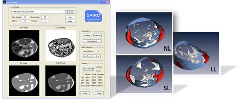 Fatextractor Software