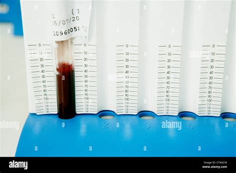 ERYTHROCYTE SEDIMENTATION RATE Stock Photo Alamy