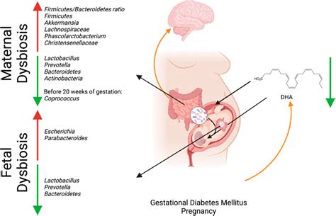 Gestational Diabetes Diagram Gestational Diabetes Treatment Services