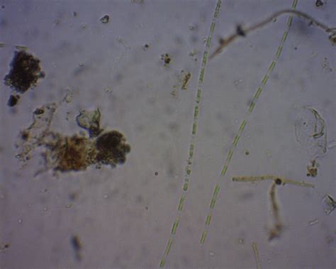 Please Identify This Filamentous Unbranched Freshwater Microalgae