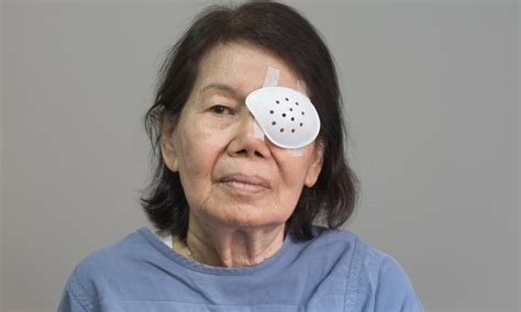 Šta Je Katarakta I Kako Se Leči Prvi Simptomi I Kada Je Vreme Za Operaciju