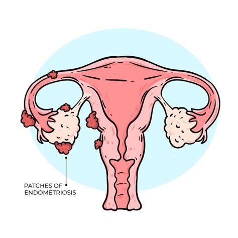 Pink Uterus Illustration Images Free Download On Freepik