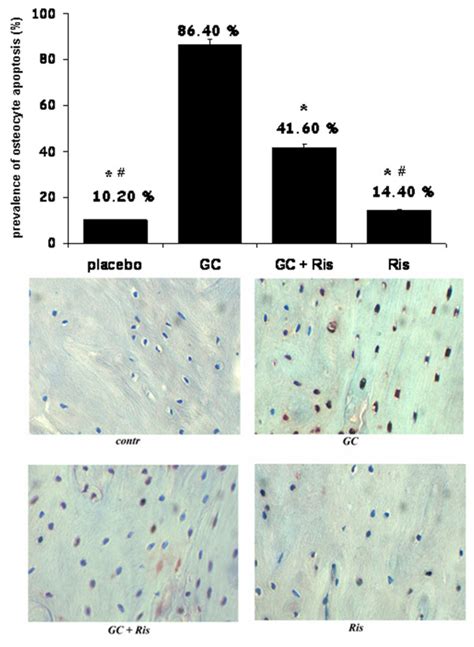 Osteocyte Apoptosis Tunel In Rats Treated With Risedronate Ris And