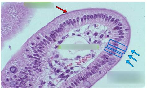 crypt villus dynamics and small intestine call response sdl typical