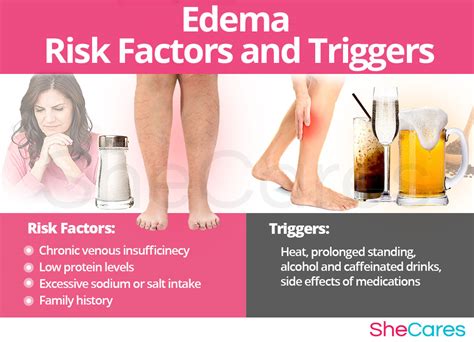 Edema SheCares