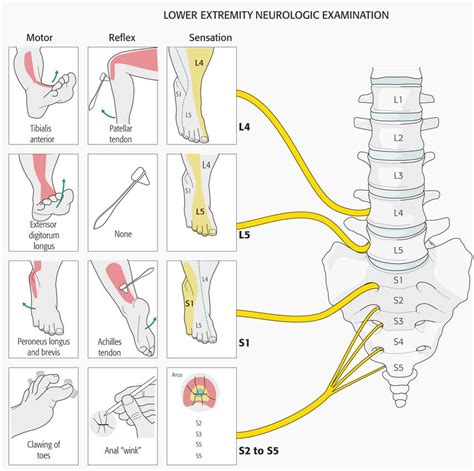 C5 C6 Cervical Radiculopathy Pinched Nerve Stretches Exercises Artofit