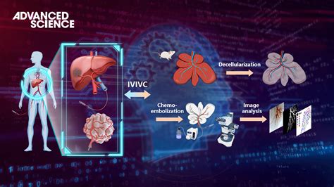 Researchers Make Advances In Field Of Transarterial Chemoembolization Modeling For Liver Cancer