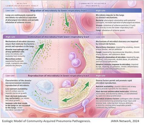 Community Acquired Pneumonia Sciencemission