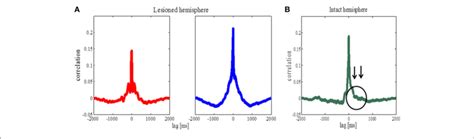 Cross Correlation Analysis Of The Lesioned And Intact Hemispheres