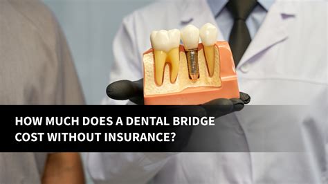 How Much Does A Dental Bridge Cost Without Insurance