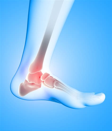 Ankle Cartilage Repair Surgery In Singapore Dr Wang Lushun