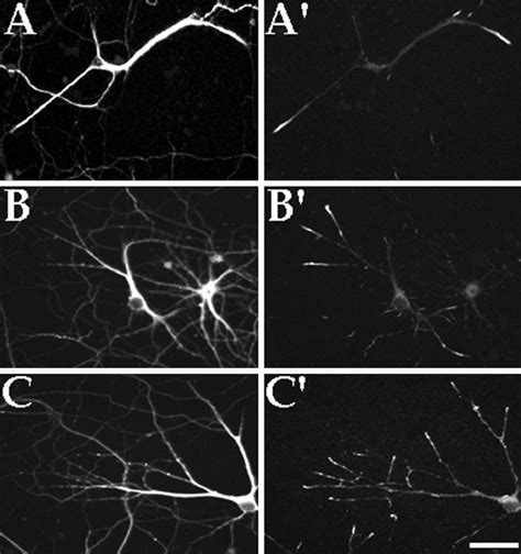 Expression Of The Mitotic Motor Protein Eg5 In Postmitotic Neurons Implications For Neuronal