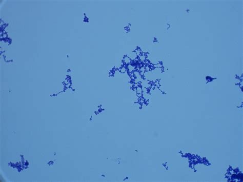 Staphylococcus Pyogenes 1000x S