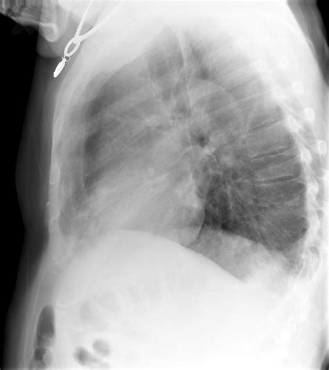 X Ray Images Database Thesimtech