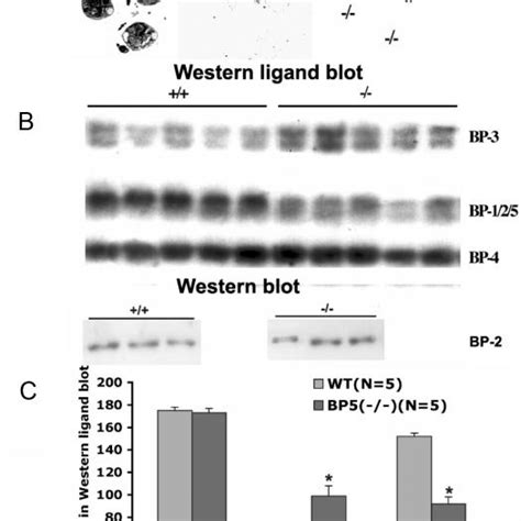 Analysis Of Igfbp Expression And Circulating Igf I Levels In Igfbp 5 Ko Download Scientific