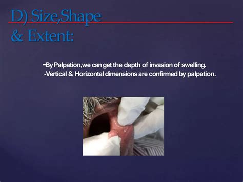 Examination Of A Swelling Pptx