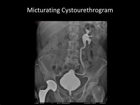 Radiology Course Urogenital Anatomy Ppt Video Online Download