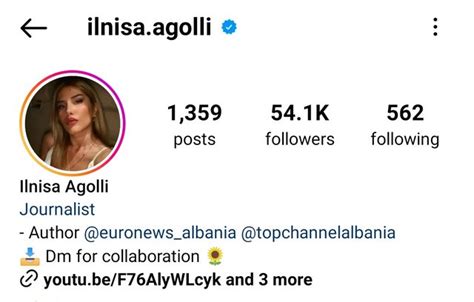 Pse Nuk Po Pi Më Ujë Bbvip Tek Rritja E Ndjekësve Në Instagram Showbiz