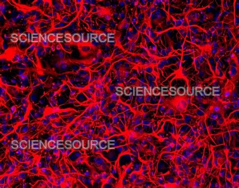 Astrocyte Cells Fluorescence Light Mi Stock Image Science Source Images