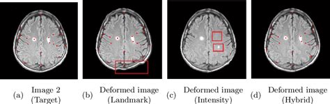 Figure 31 From With Large Deformations Via Quasi Conformal Maps
