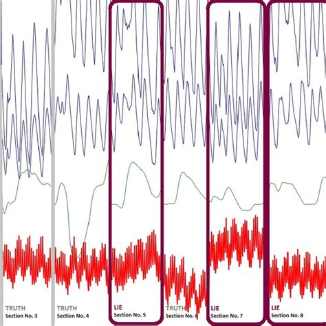 Polygraph Diagram In Which Sections Corresponding To Each Of The 10 Download Scientific Diagram