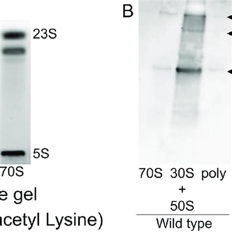 Analysis Of Polysomal Gradient Profiling Fractions A Agarose Rna
